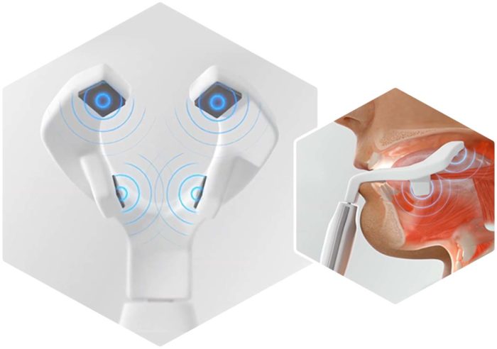 How It Works - eXciteOSA